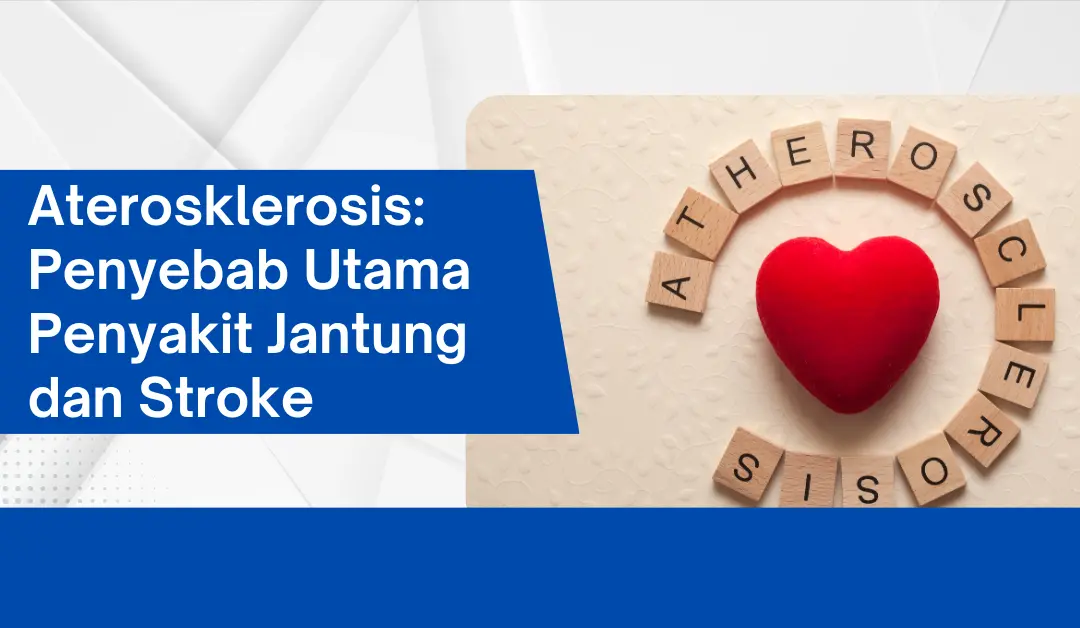 Aterosklerosis: Penyebab Utama Penyakit Jantung dan Stroke